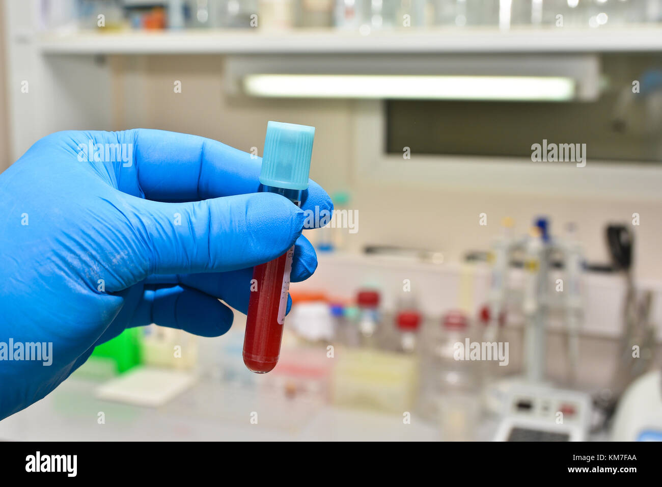 Blood test in the laboratory. The test tube with a biological sample ...
