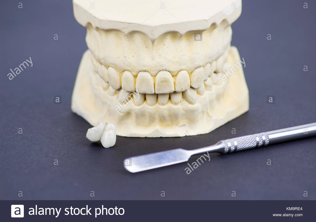 Crown Molding High Resolution Stock Photography and Images - Alamy