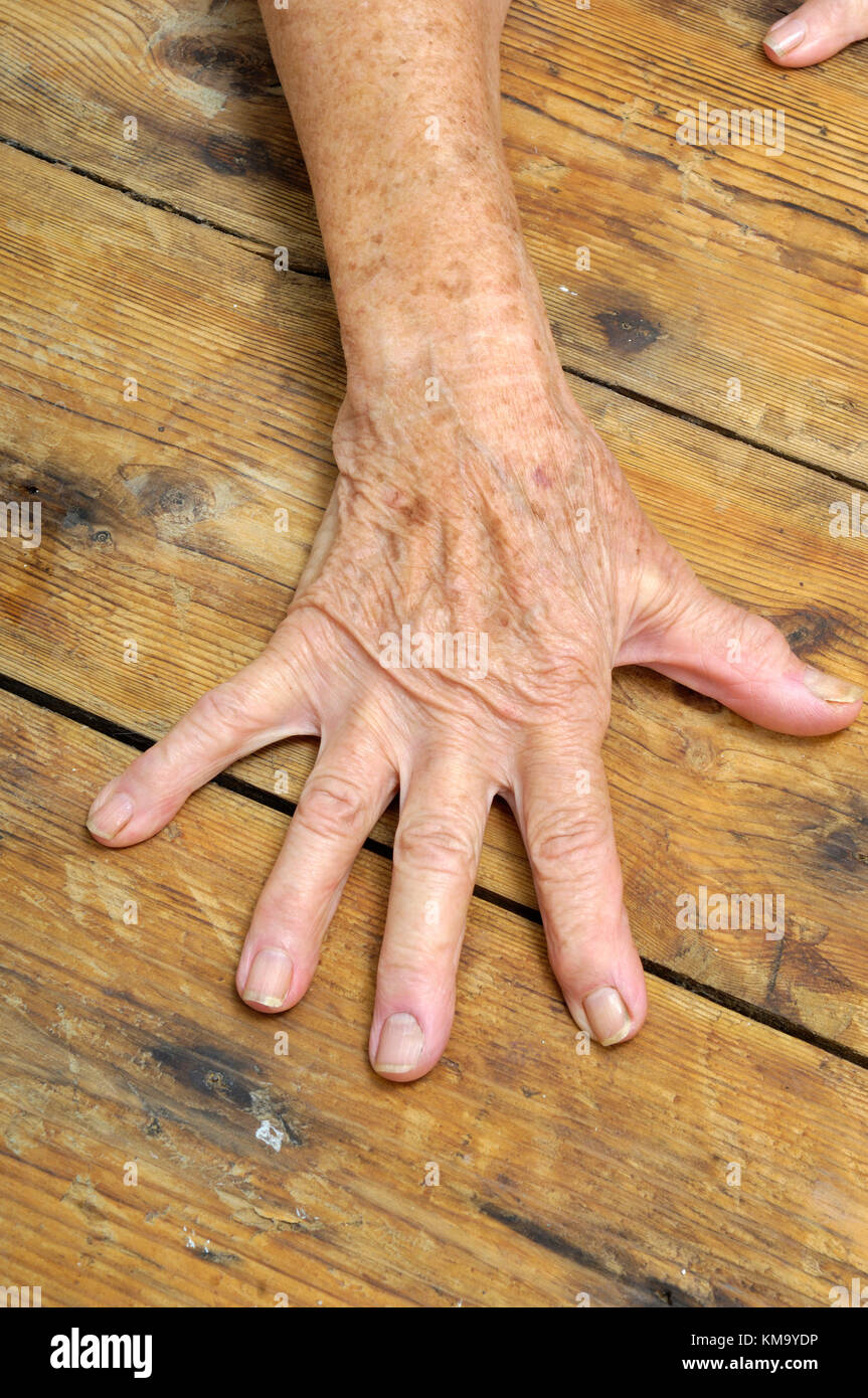 detail of senior woman hands Stock Photo - Alamy