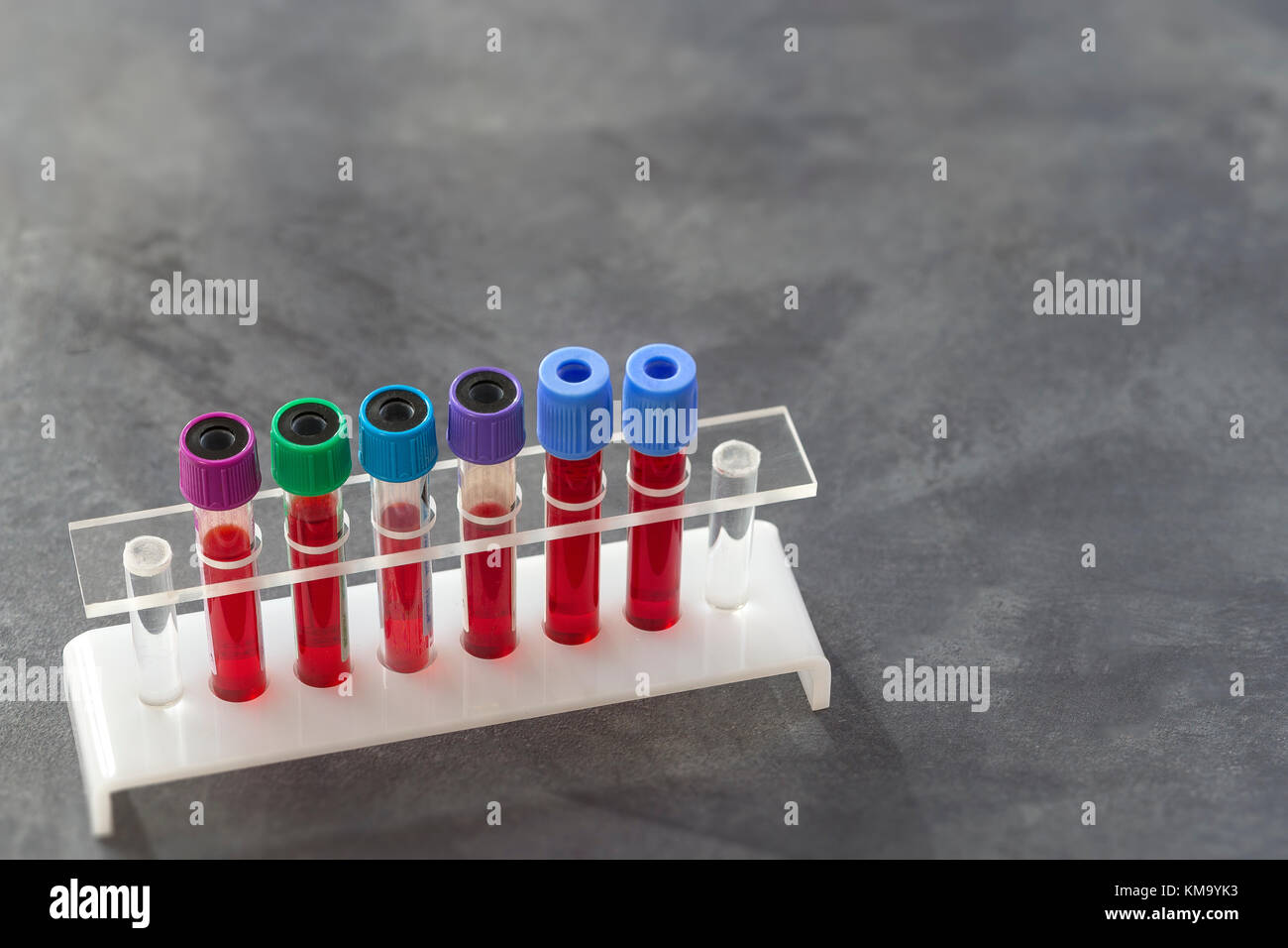 Vacutainer blood collection tube hi-res stock photography and images ...