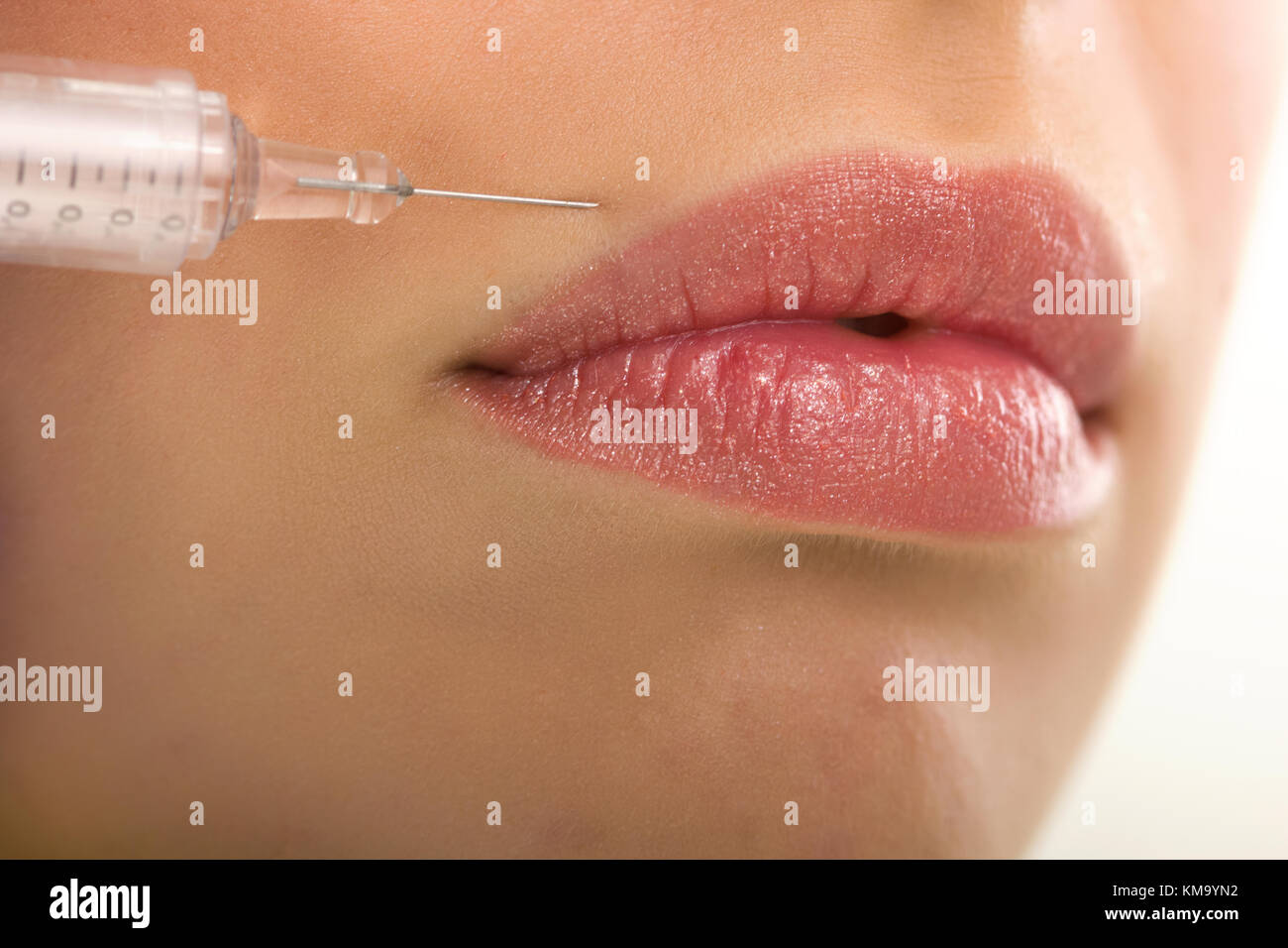 Botox shot in the female cheek,close up Stock Photo - Alamy