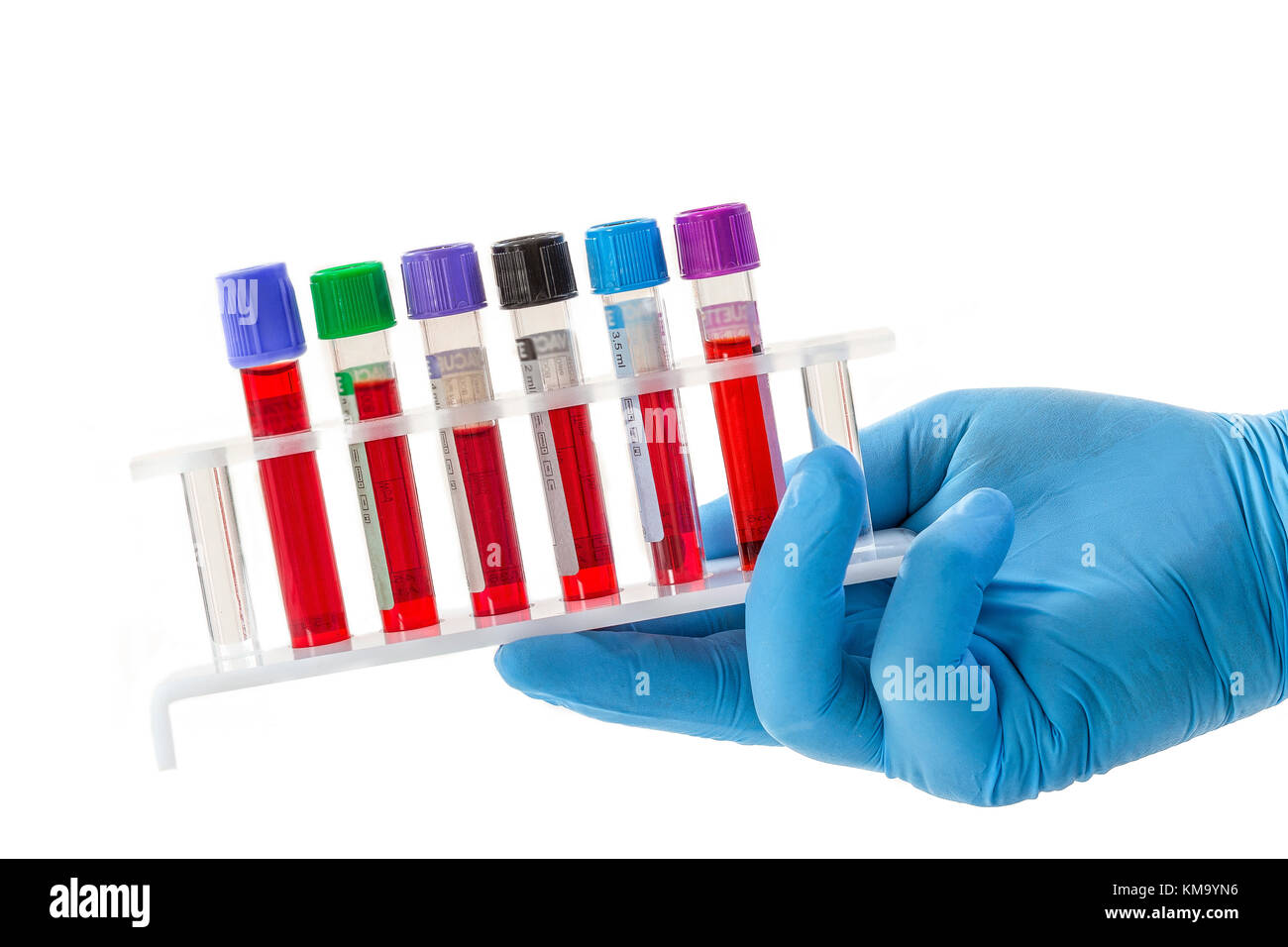 doctor or lab technician hand holnding a rack of blood sample test ...