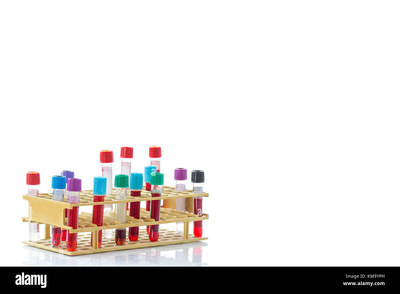 view from of a bic rack of blood sample test tubes on white background ...