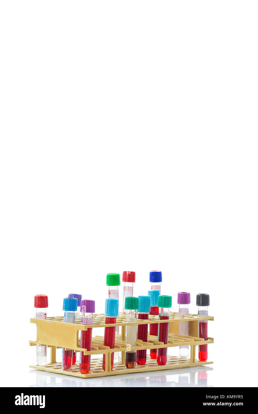 view from of a bic rack of blood sample test tubes on white background ...