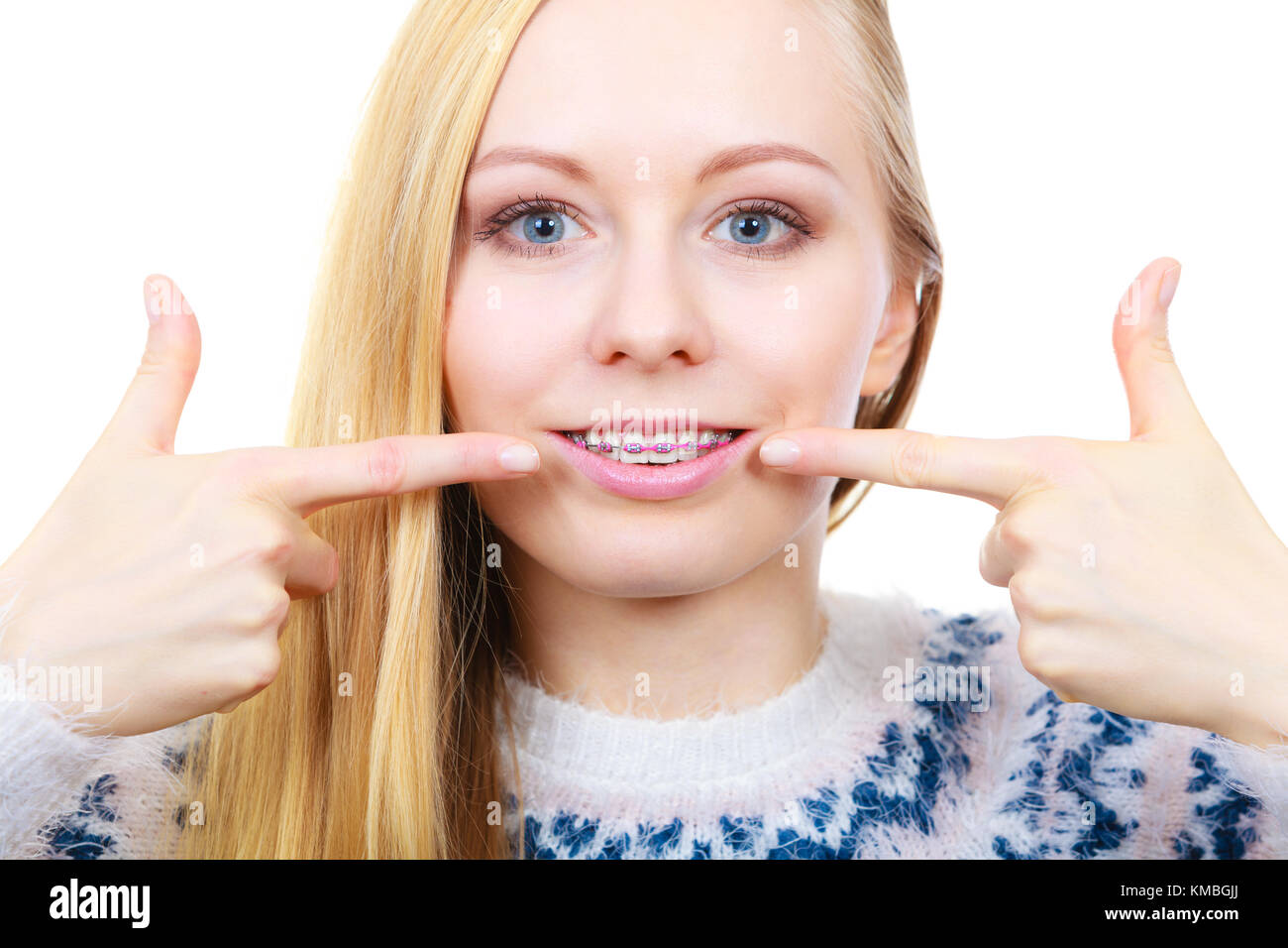 Orthodontist dentistry treatment concept. Happy smiling woman pointing ...