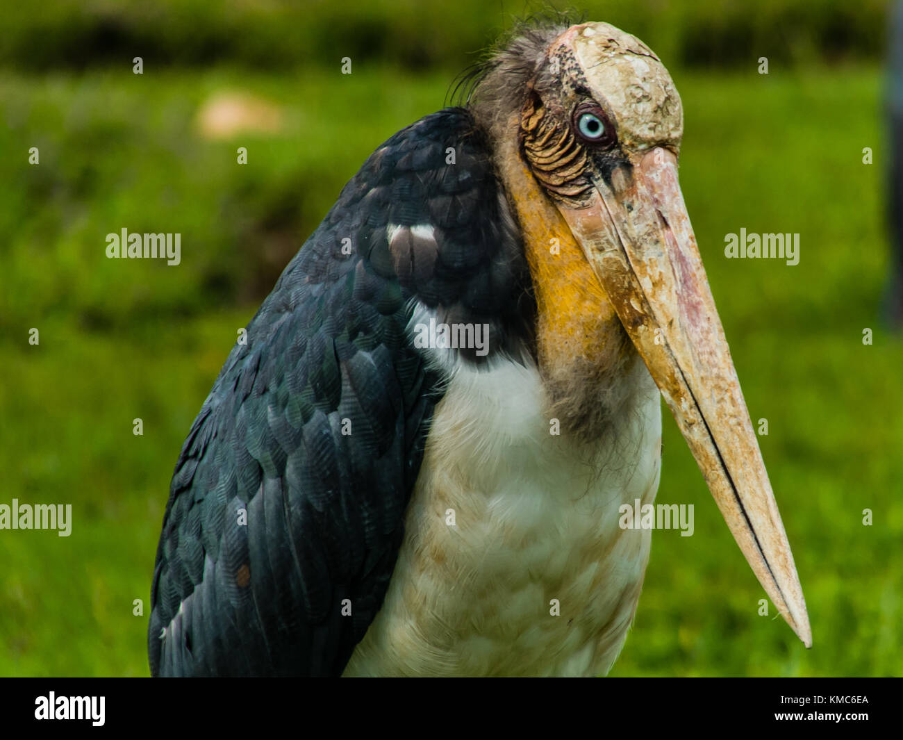 Goiter Stock Photos & Goiter Stock Images - Alamy