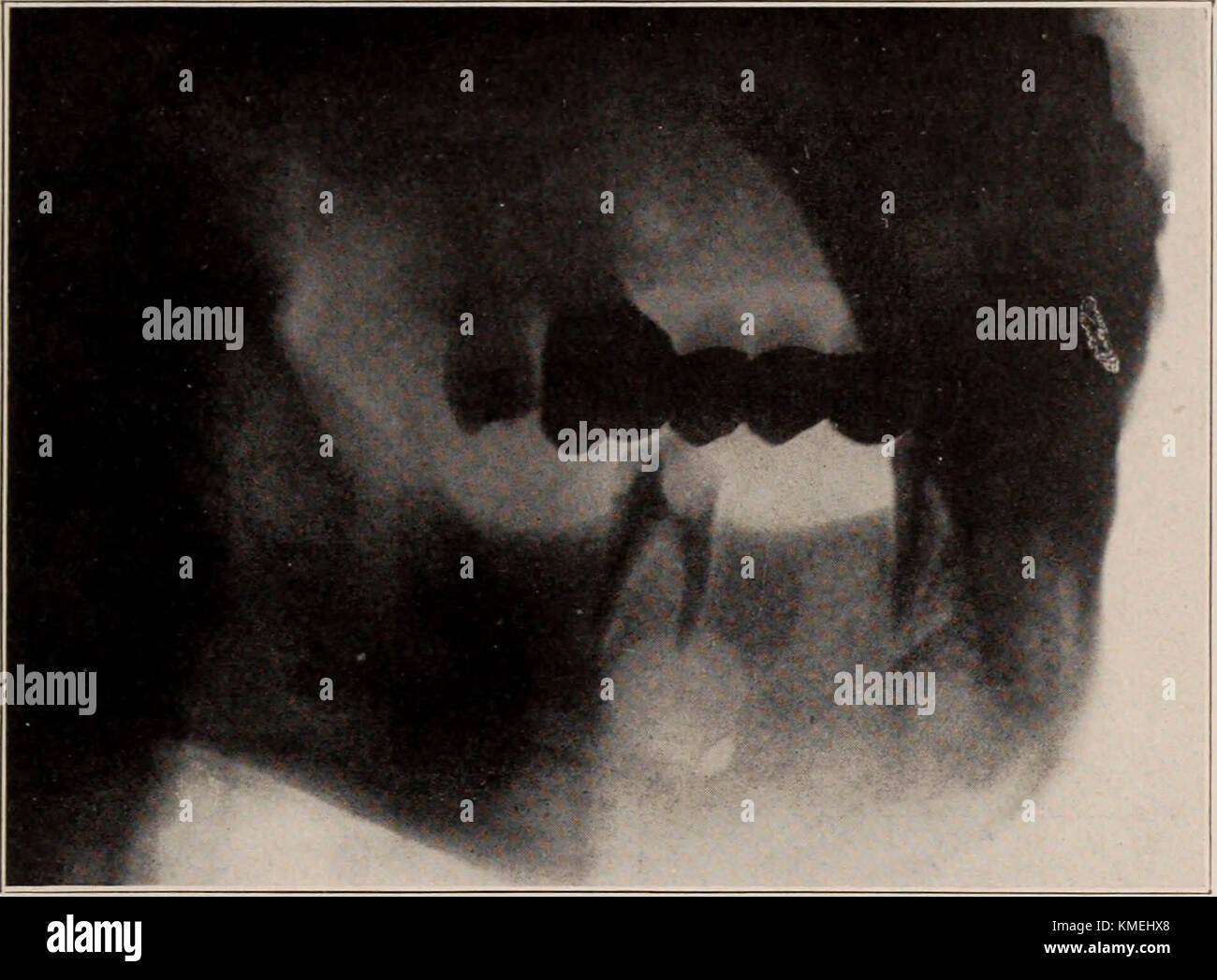 "Dental and oral radiography : a text book for students and ...