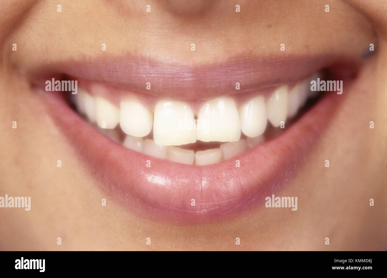 Sparkling Teeth Woman Stock Photos & Sparkling Teeth Woman Stock Images ...