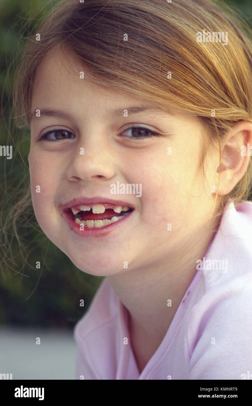 Missing toothless facial hi-res stock photography and images - Alamy