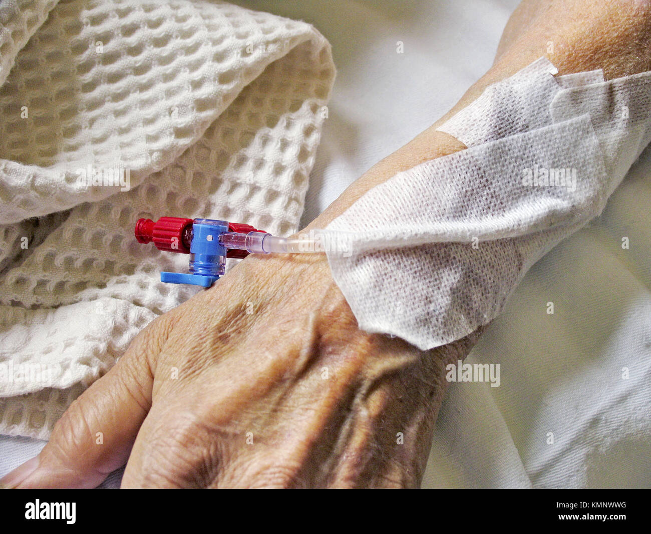 Intubate hi-res stock photography and images - Alamy