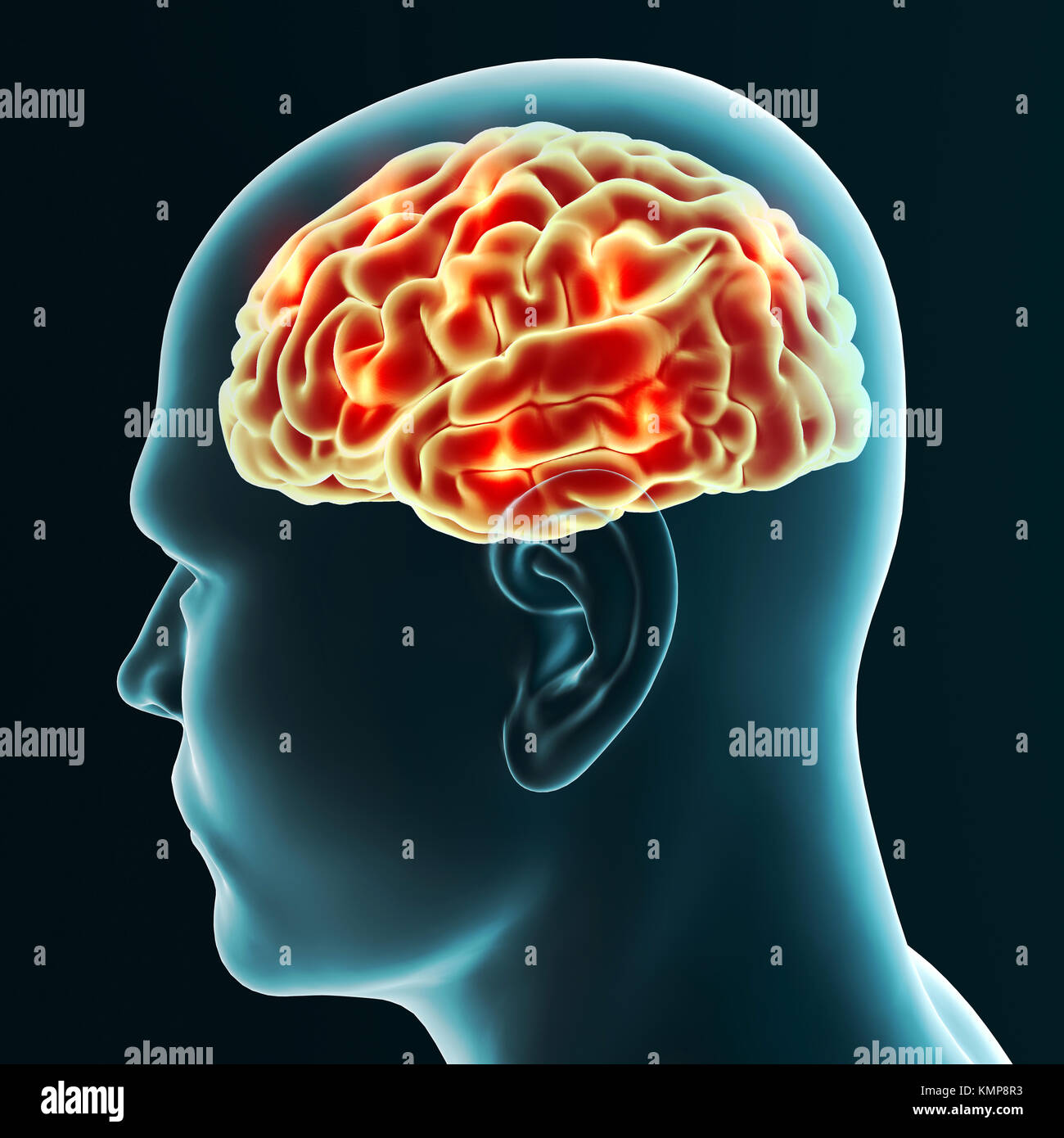 Alzheimers brain hi-res stock photography and images - Alamy