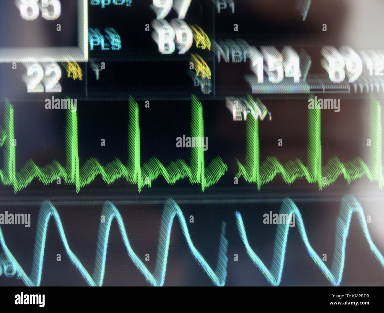 Vital functions hi-res stock photography and images - Alamy