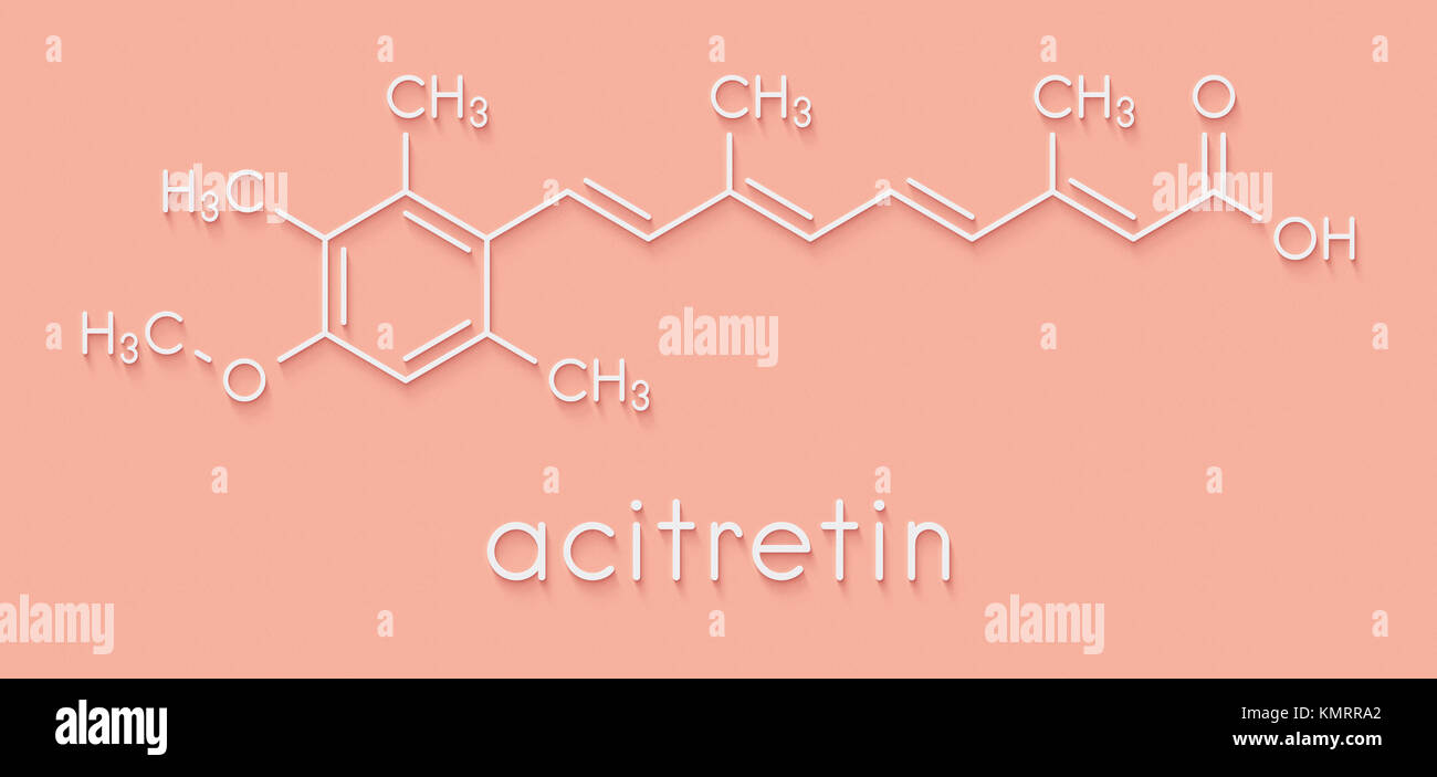 Acitretin psoriasis drug molecule. Skeletal formula Stock Photo - Alamy