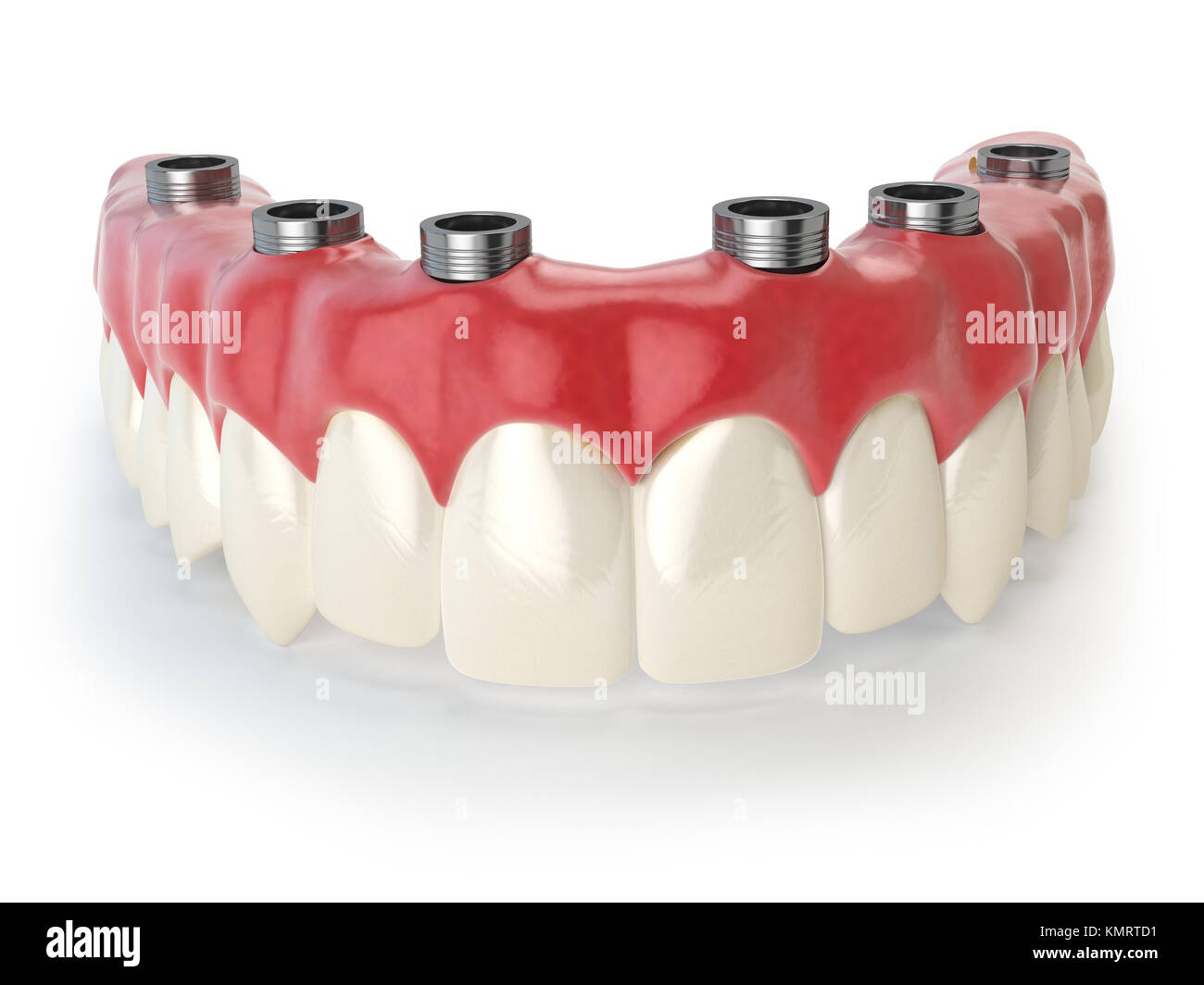 Prothesis hi-res stock photography and images - Alamy