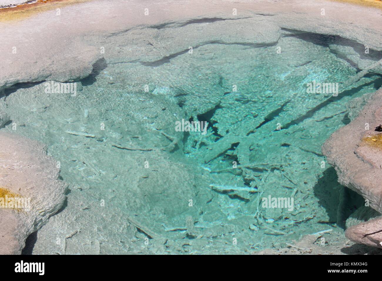 Filamentous Bacteria Stock Photos & Filamentous Bacteria Stock Images ...