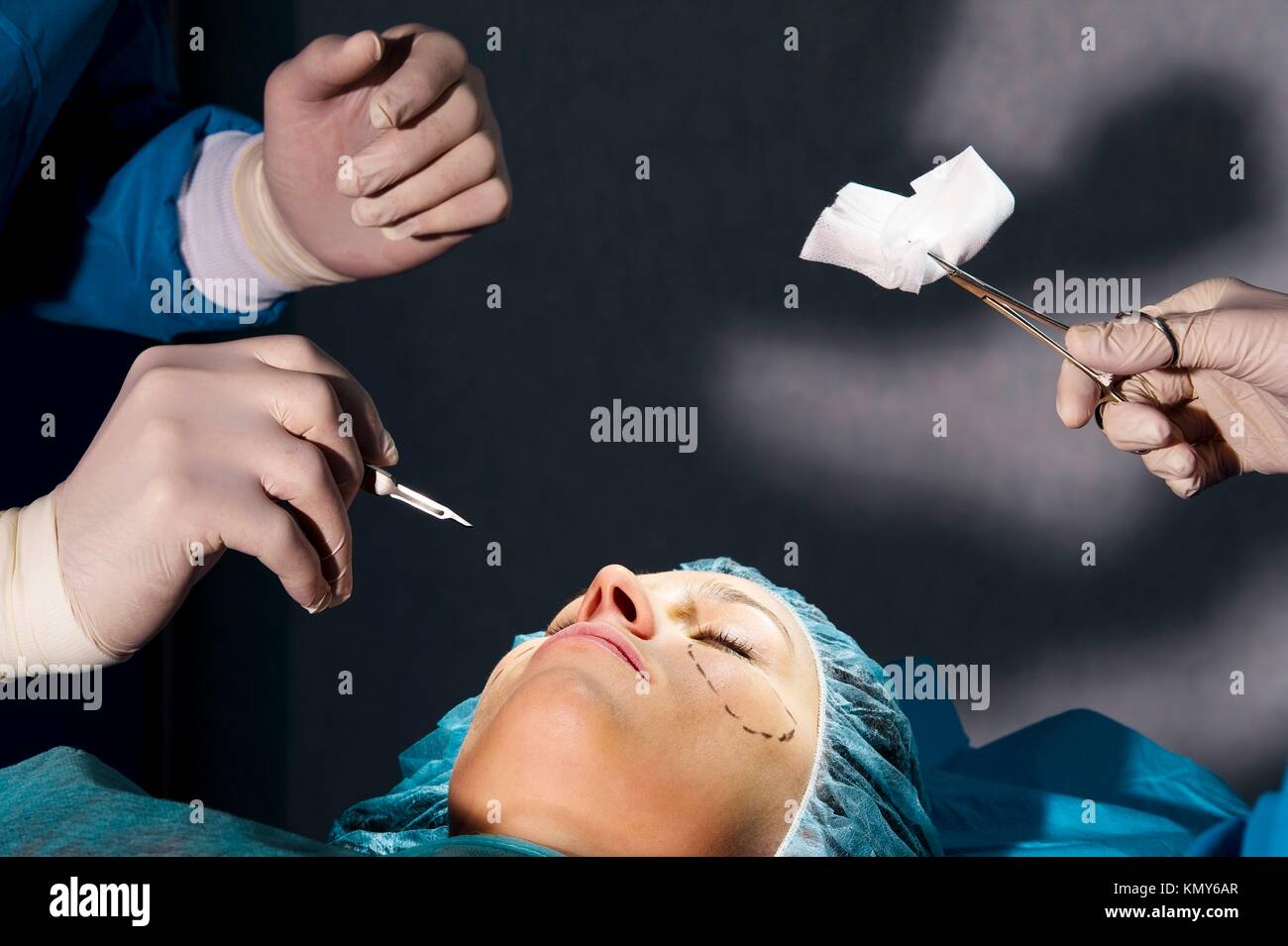 Woman receiving Plastic Operation Stock Photo - Alamy