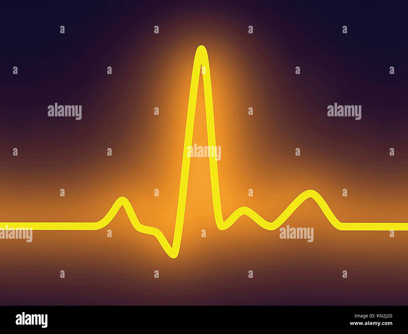 Heart Rate Graph Ecg Illustration High Resolution Stock Photography and ...