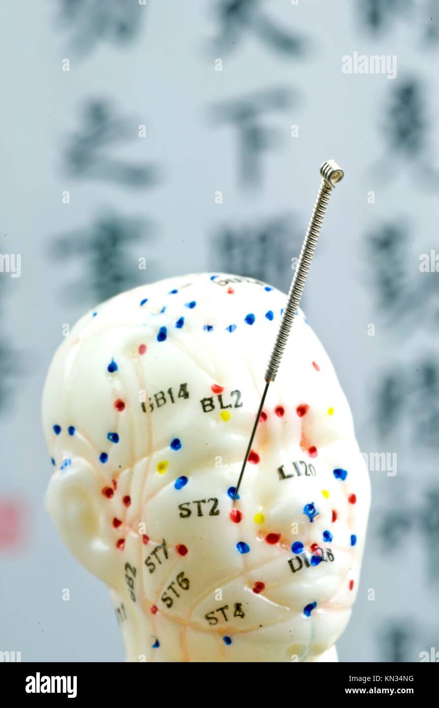 acupuncture demonstration on model Stock Photo - Alamy