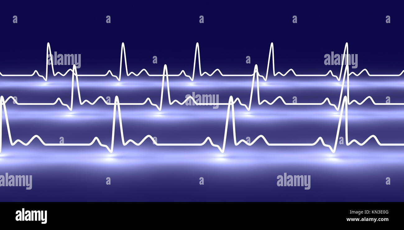 3D rendered Illustration. Heartbeat graph Stock Photo - Alamy