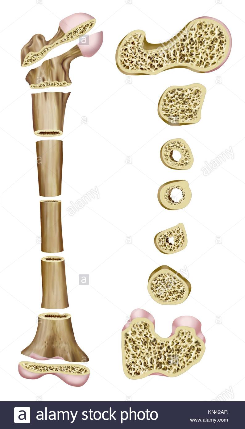 Medullary Cavity Stock Photos & Medullary Cavity Stock Images - Alamy