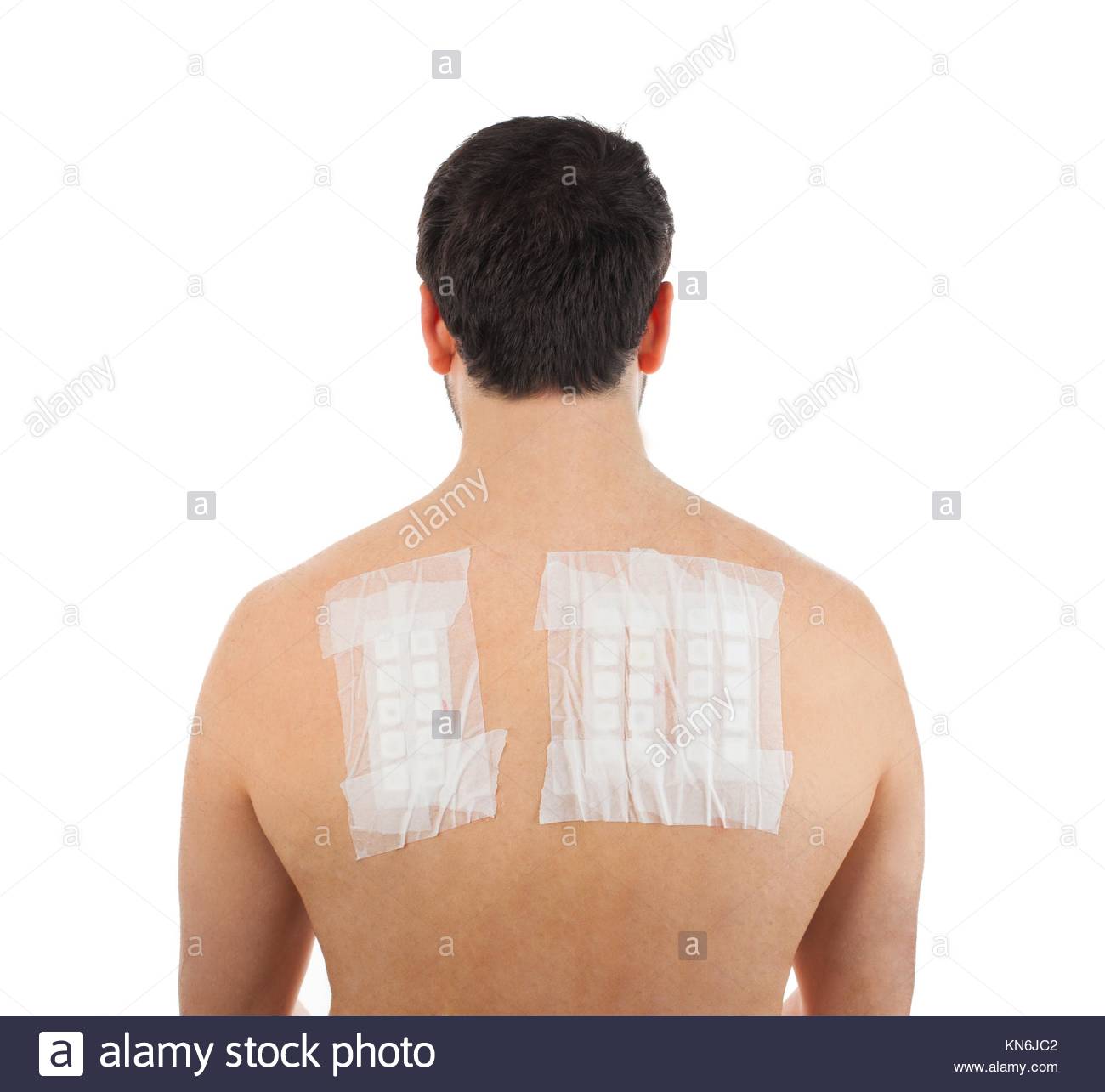 Allergy Test Stock Photos & Allergy Test Stock Images - Alamy