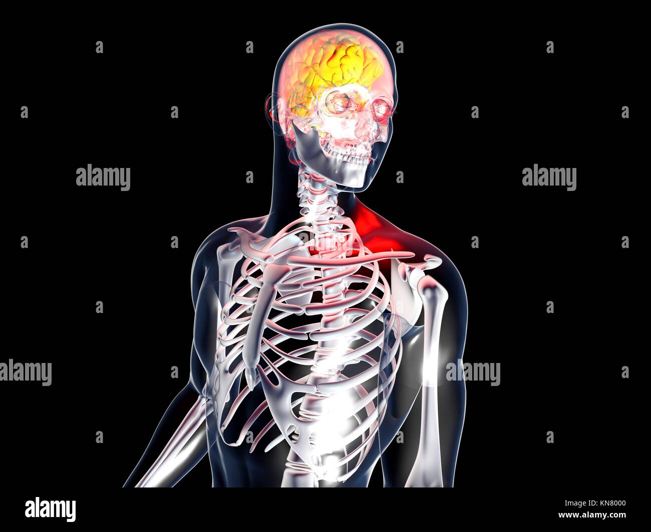 Brain scan depression hi-res stock photography and images - Alamy