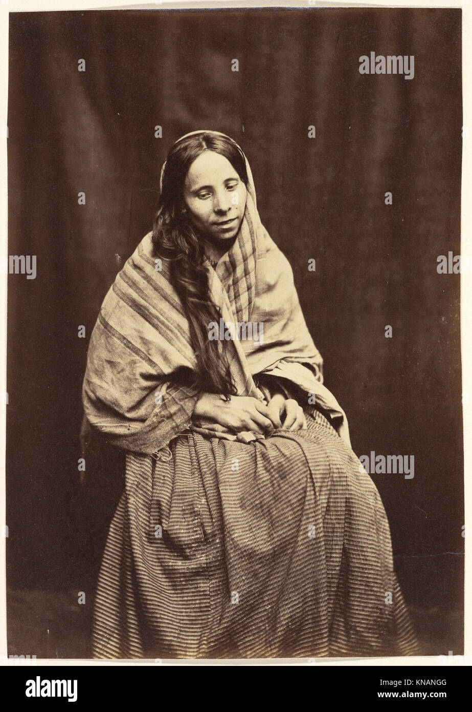 This photograph depicts a patient from the Surrey County Lunatic Asylum ...