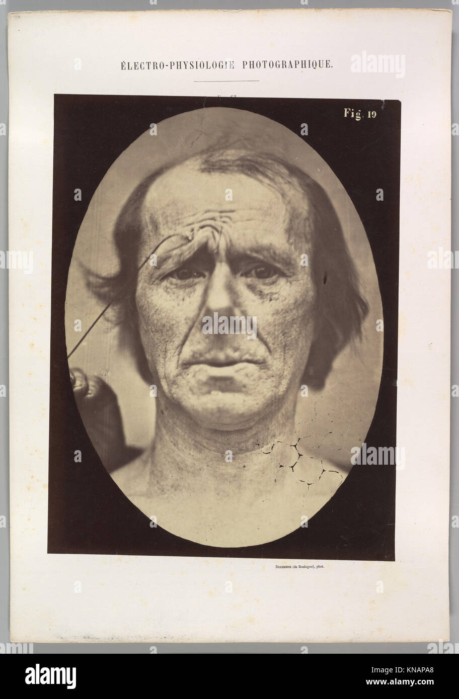 This figure depicts the theme of suffering, captured in a work of art ...