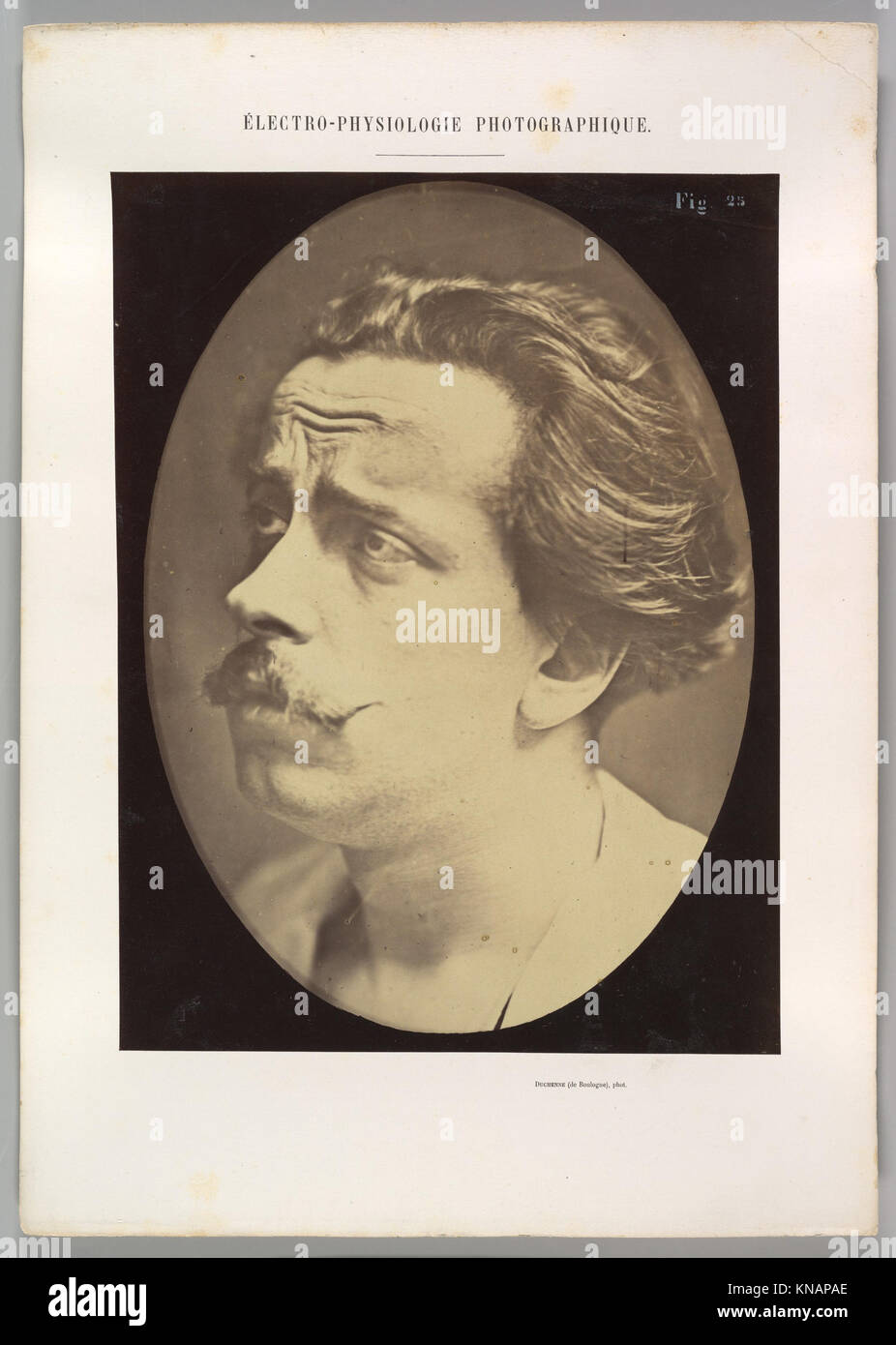 Emotion anatomy hi-res stock photography and images - Alamy