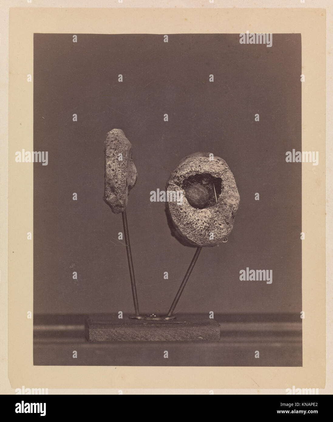 This artifact displays an excised knee joint with a musket ball in the ...