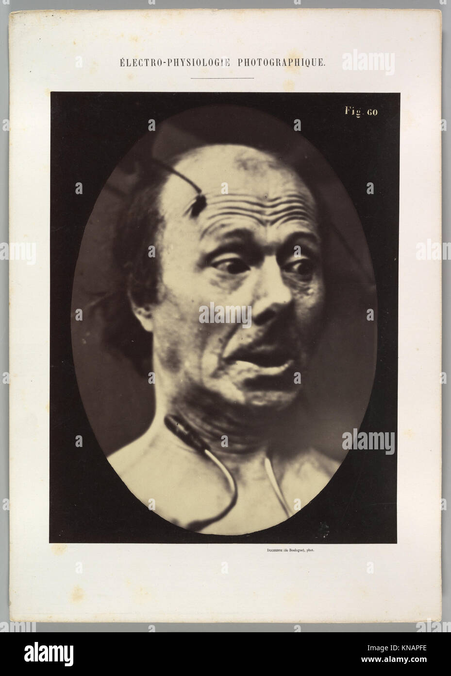 This figure, labeled 'Fright,' depicts a dramatic expression of fear or ...