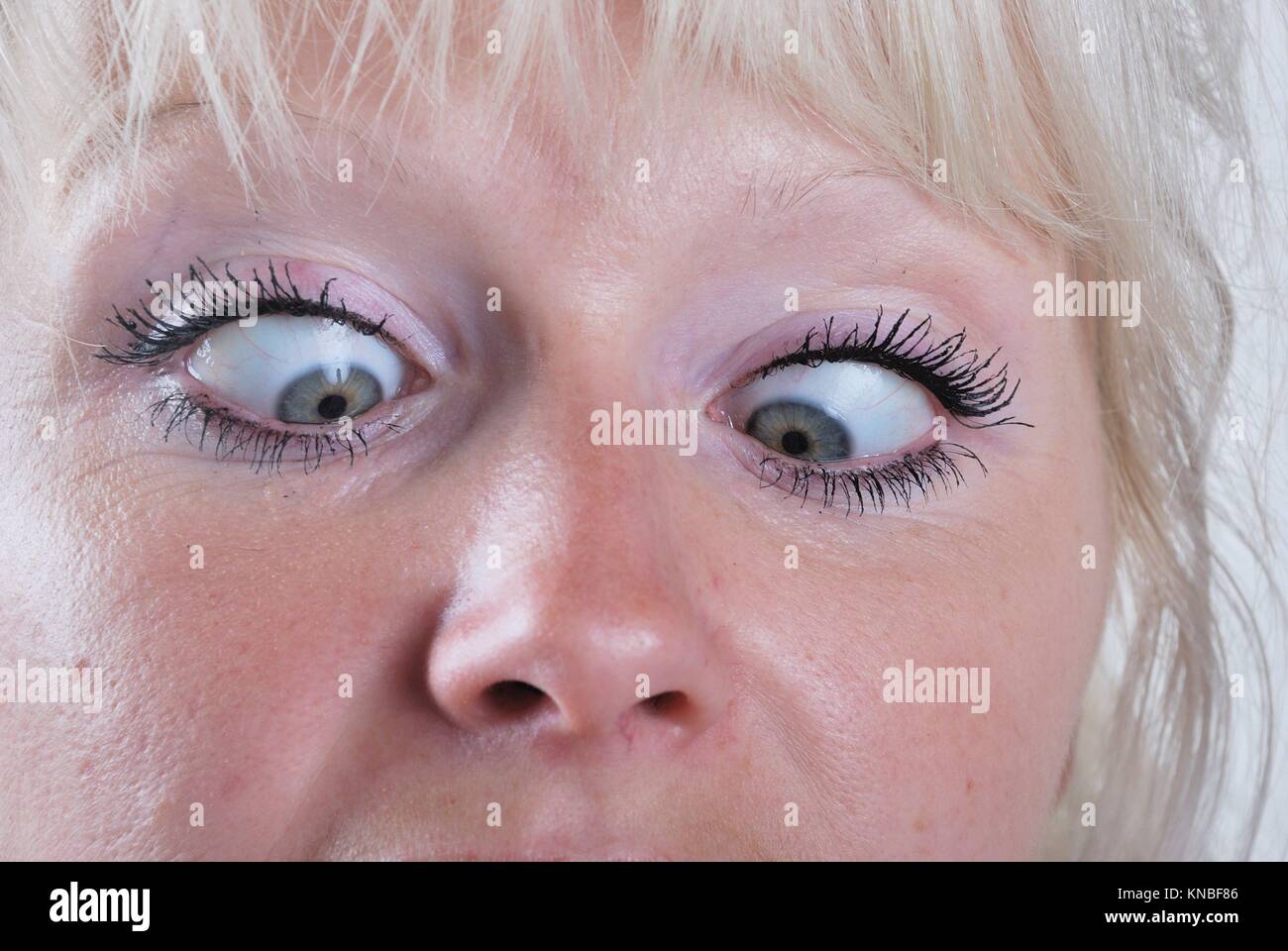 Squint Woman Eye High Resolution Stock Photography and Images - Alamy