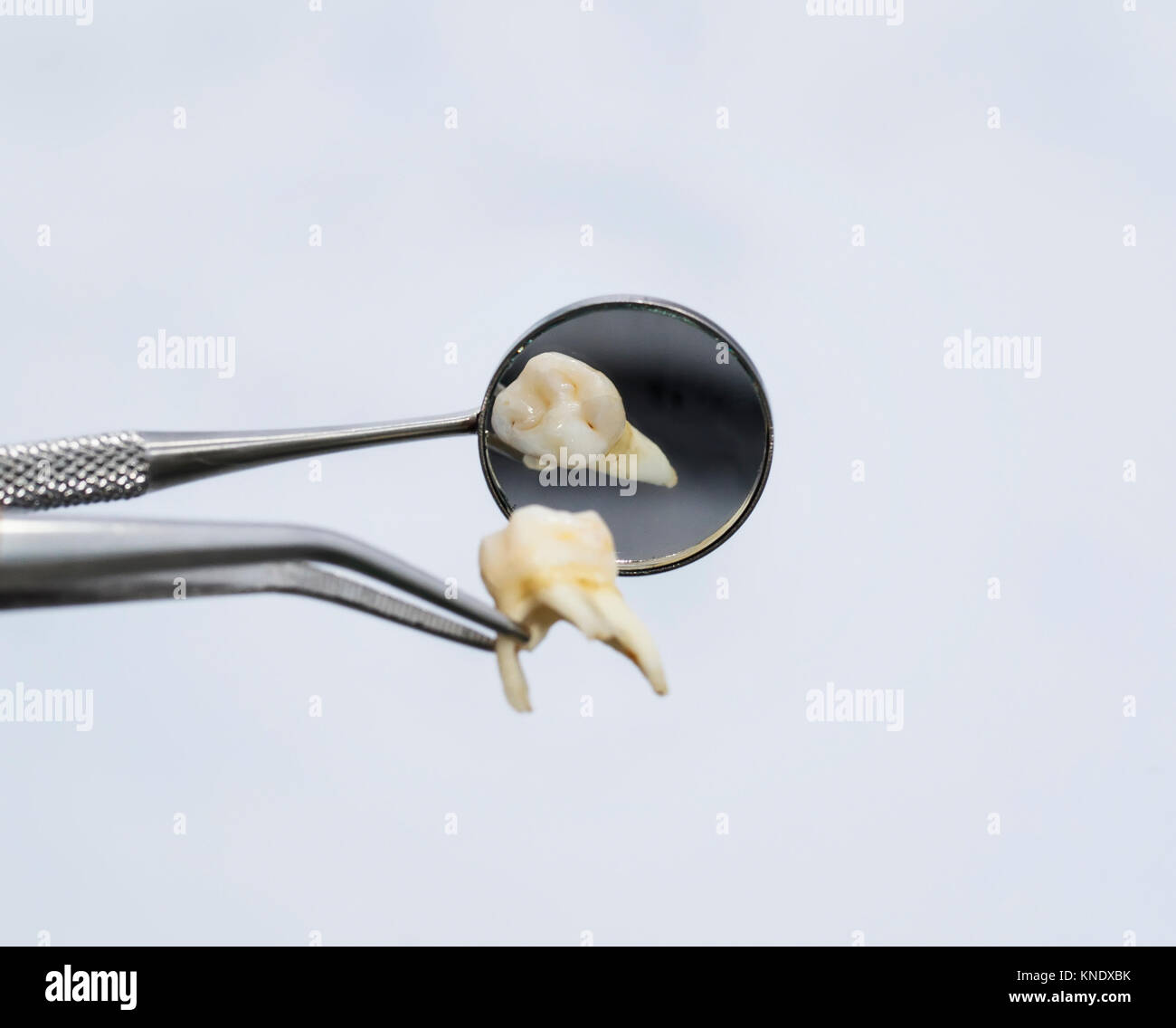 bad rotten tooth pulled out with metal forceps and is reflected in the ...