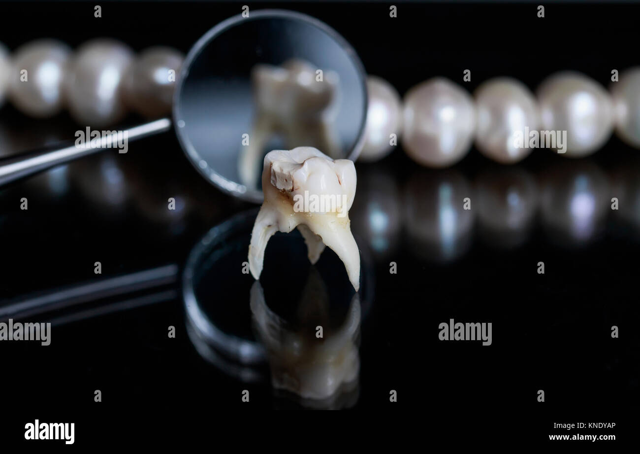 bad rotten tooth pulled and stands opposite the offices of the mirrors ...