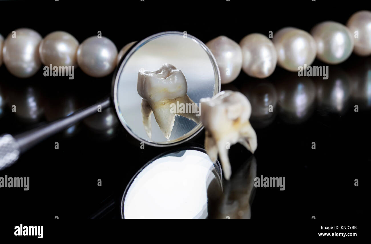 bad rotten tooth pulled and stands opposite the offices of the mirrors ...