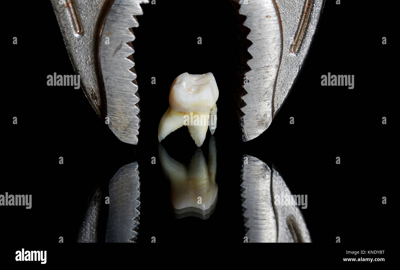 scary metal tongs over a bad rotten tooth pulled and stands on a black ...