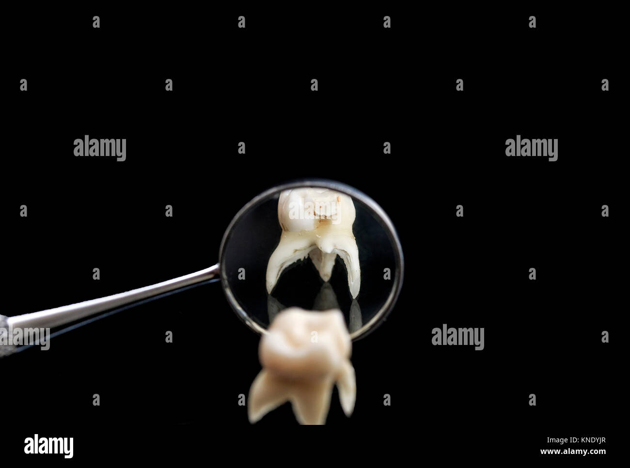 bad rotten tooth is pulled out and is located opposite the dental ...