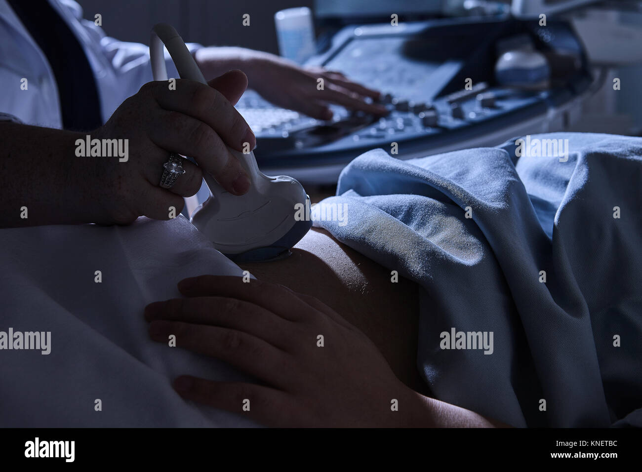 Cropped view of sonographer giving pregnant patient ultrasound scan ...