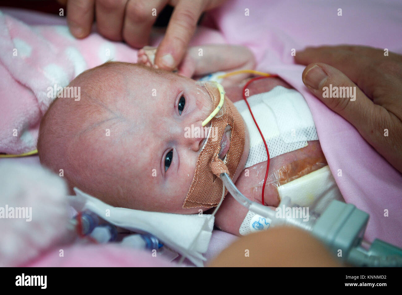 EMBARGOED TO 2230 TUESDAY DECEMBER 12 Three-week-old Vanellope Hope ...