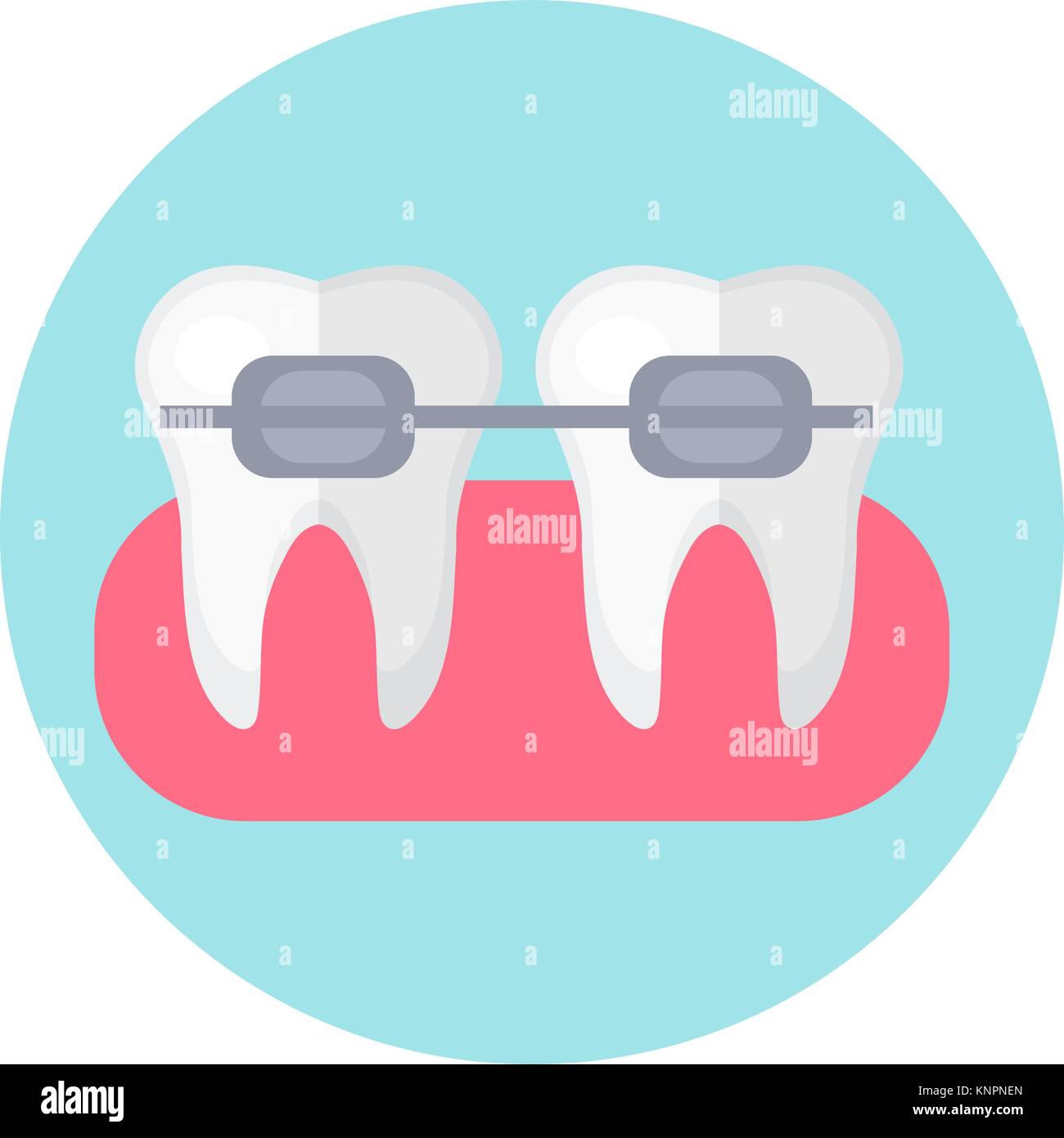 Orthodontic Brackets High Resolution Stock Photography and Images - Alamy