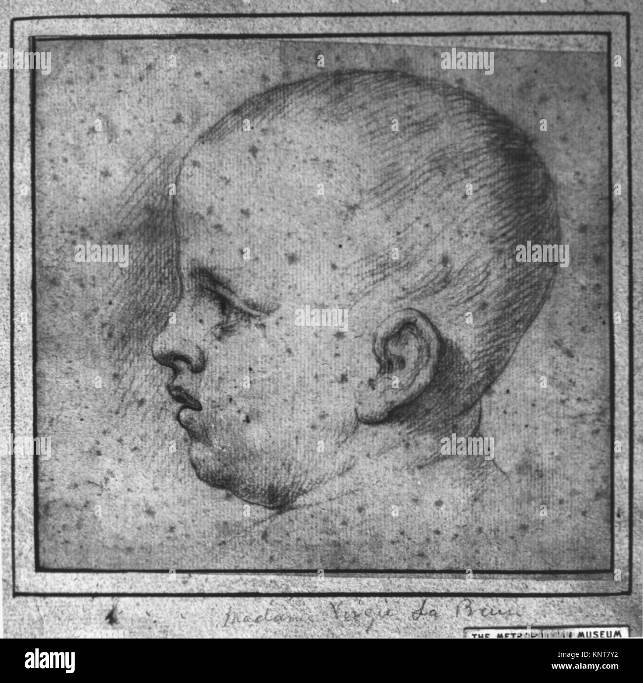 Detailed illustration of a child's head showing facial features, hair ...