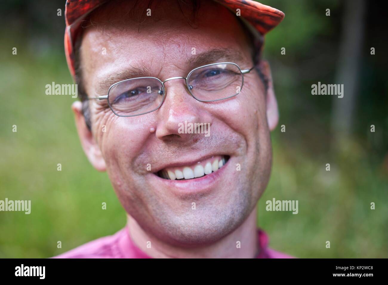 Wart on face hi-res stock photography and images - Alamy