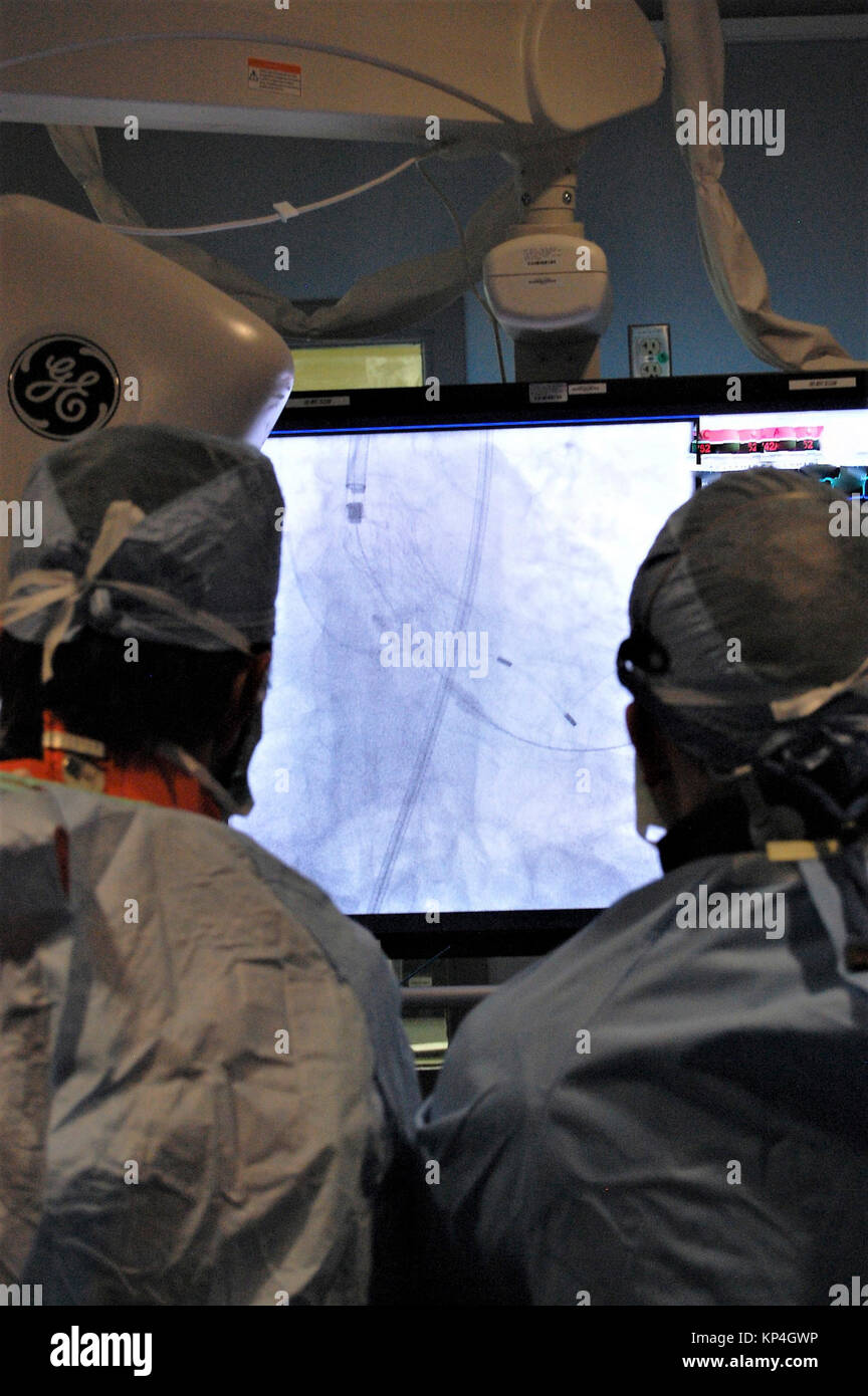 Cardiologists position a Transcatheter Aortic Valve Replacement (TAVR ...