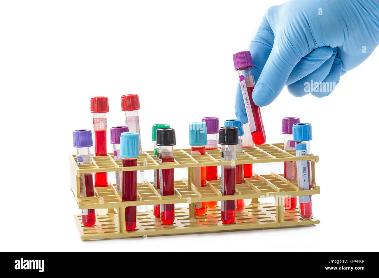 Analysis sample hi-res stock photography and images - Alamy