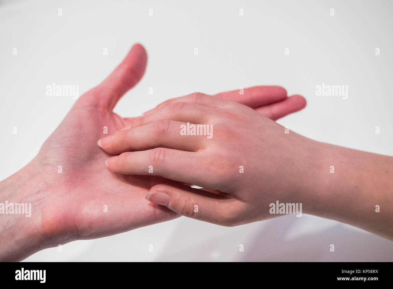 Prosthetic hand hi-res stock photography and images - Alamy
