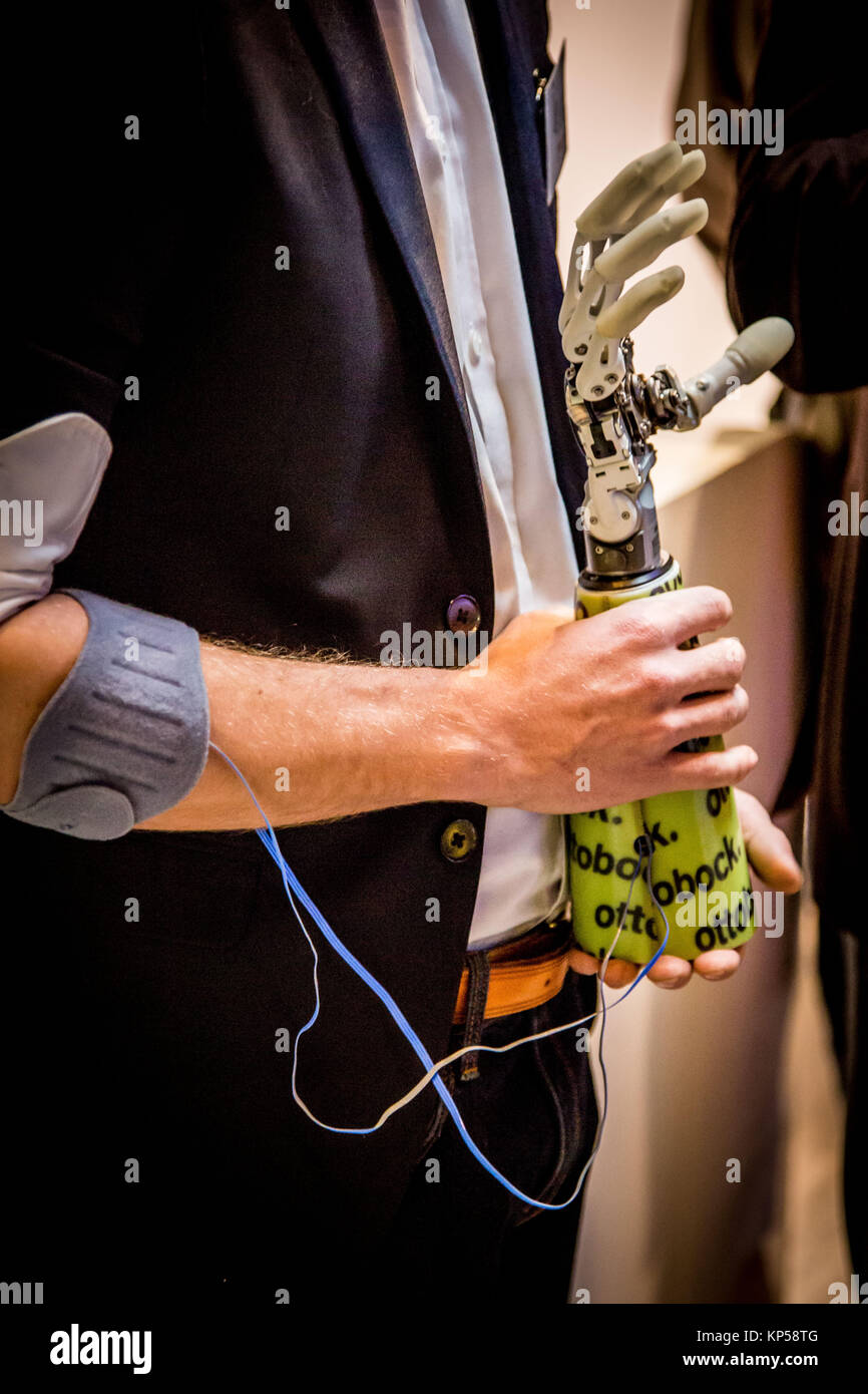 Prosthetic hand hi-res stock photography and images - Alamy