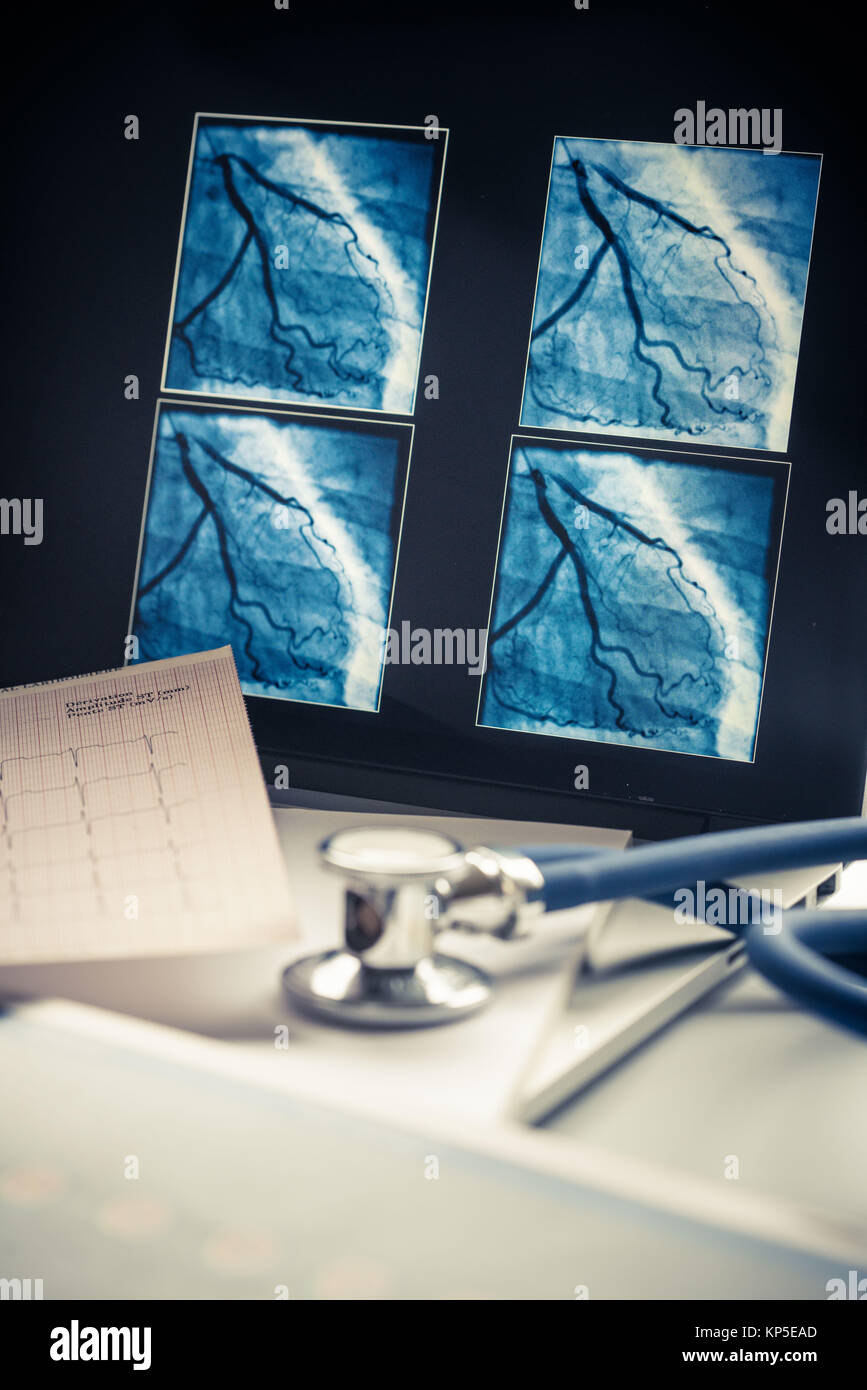 Ecg and angiogram hi-res stock photography and images - Alamy