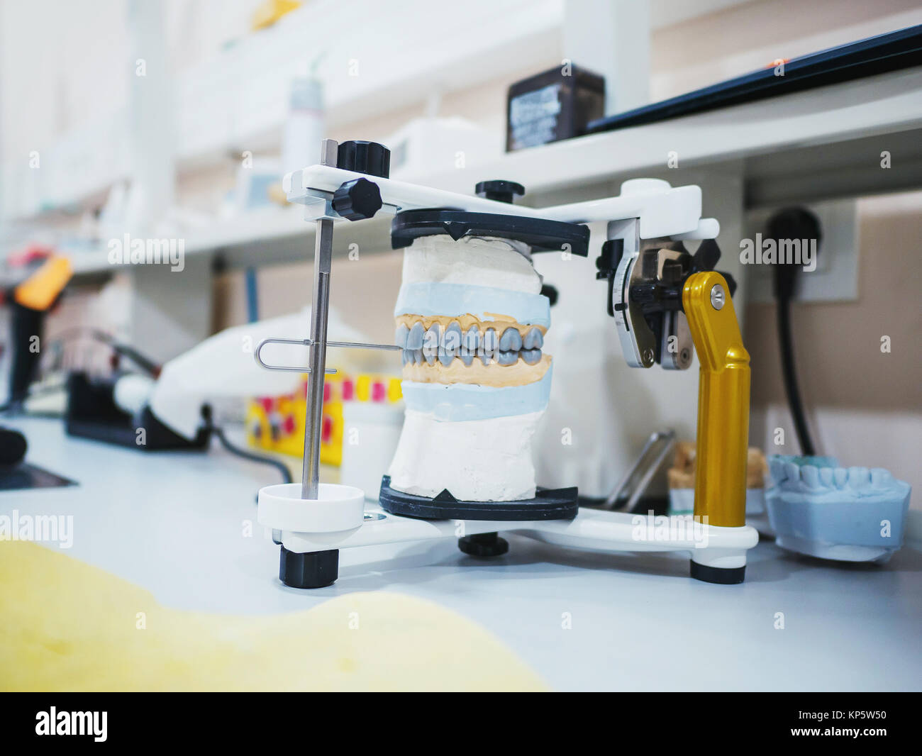 Dentists tooth plastic model with screw implant for teaching, learning ...