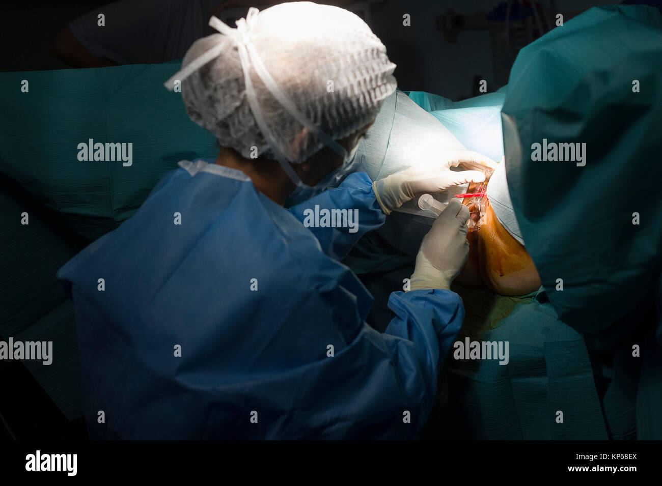 Assisted Reproductive Technology High Resolution Stock Photography and ...