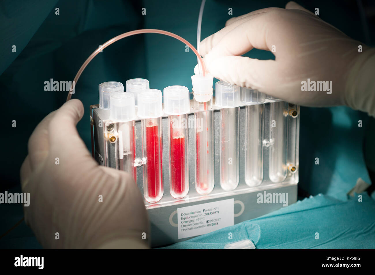 ASSISTED REPRODUCTIVE TECHNOLOGY Stock Photo - Alamy